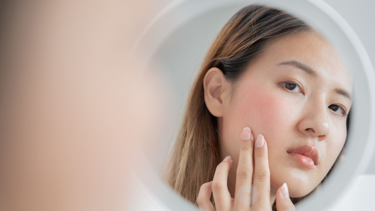 Why Do Alcoholics Have Red Faces? | Alcoholic Rosacea