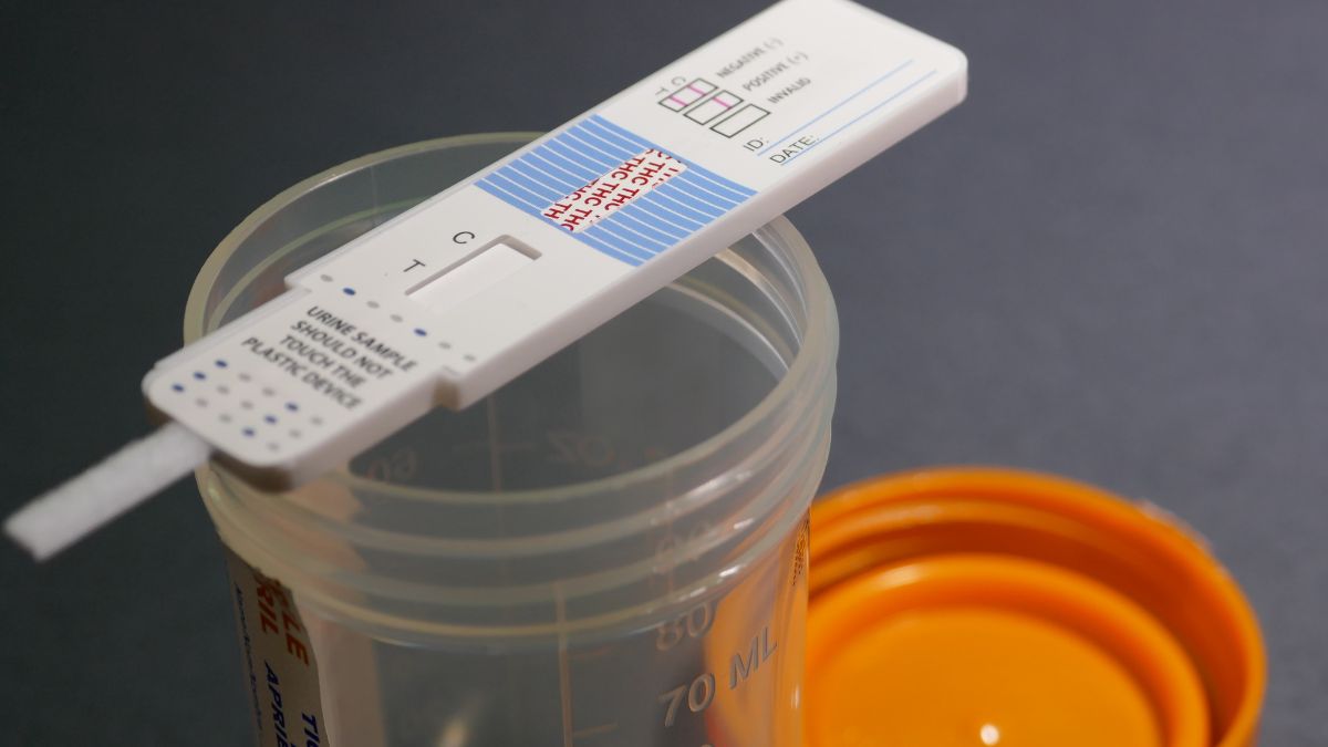 What Is an EtG Alcohol Test? | Retreat of Atlanta